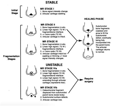 Knee Osteochondritis Dissecans Care Sports Medicine Review