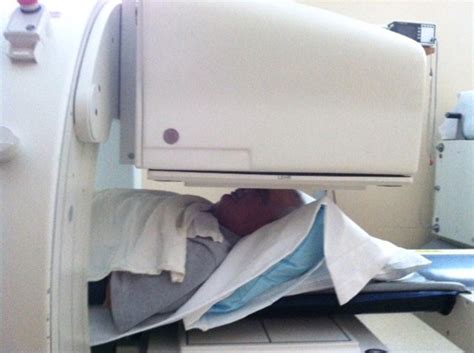 Nuclear Bone Scan For Prostate Cancer HubPages