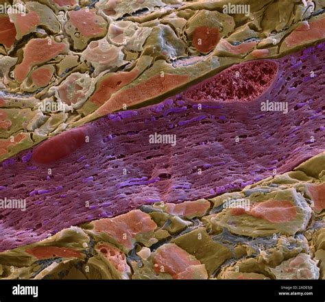 Normal Muscle Tissue Coloured Scanning Electron Micrograph Sem Of A