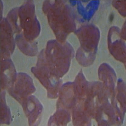 Github Mranaydongre Bloodcell Detection Datatset This Is A Dataset Of Blood Cells Photos