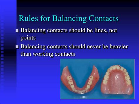 Ppt Philosophies Of Occlusion For Implants Powerpoint Presentation