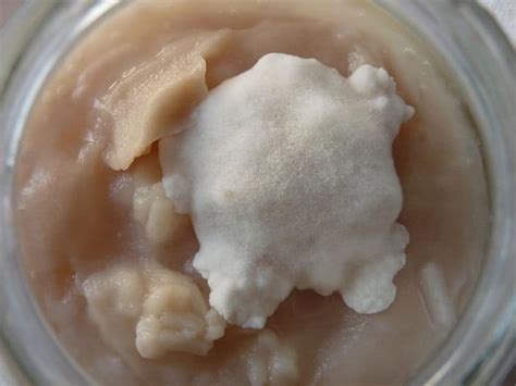 Rhizopus Oryzae Characteristics Genome Disease Mold Busters