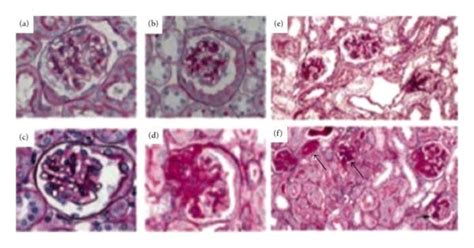 glomerular histopathology in enos− − db db mice representative