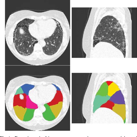 Automatic Segmentation Of Pulmonary Segments From Volumetric Chest Ct