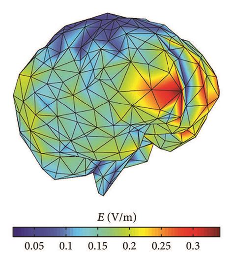 Induced Electric Field On The Surface Of The Brain Due To 1800 Mhz Download Scientific Diagram