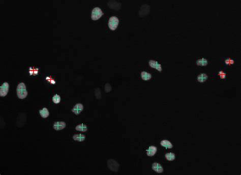 Object Detection Mia Documentation