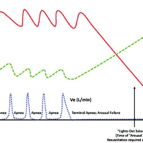 Respiratory Compromise Clinical Cascade Download Scientific Diagram