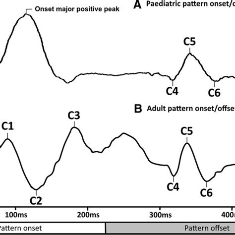 Pattern Onset And Offset Visual Evoked Potentials In The Diagnosis Of