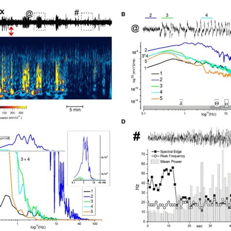 Figure Description And Analysis Of Unusual Cortical Eeg Events After