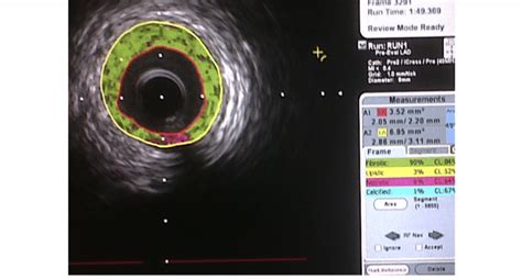 Color Coding Imap Of One Of Lesions Download Scientific Diagram