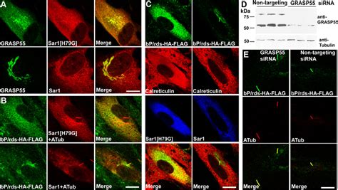 Cilia Targeting Of Prds In Cilia Is Dependent On Copii But Not On The Cilia Targeting Of Prds In Cilia Is Dependent On Copii But Not On The
