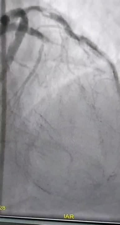 Pci To Tough Cto Lad Jcto 4 Michael Gergis Posted On The Topic Linkedin