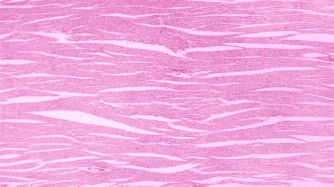 Battle Of The Sexes What Does It Mean For Heart Health