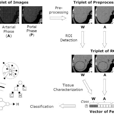 The System For Texture Based Classification Of Liver Tissues First
