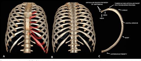 Figure 1 From Anatomical Variations And Congenital Anomalies Of The