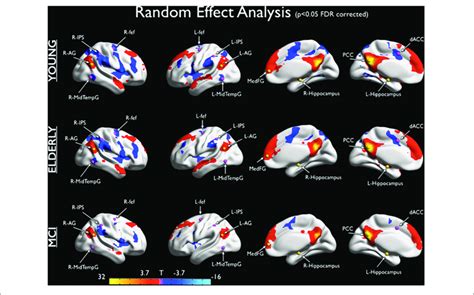 Default Network Dn And Dorsal Attention Network Dan Download
