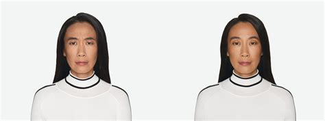 Daxxify Julene Samuels MD FACS Aesthetic Plastic Surgeon Norton Commons Louisville KY