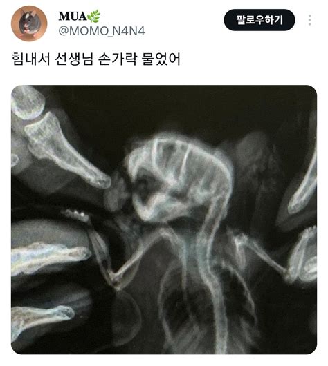 이슈 유머 성질이 엄청났다는 햄스터 엑스레이 후기