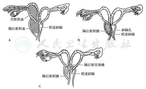 疾病详情 疾病 人卫临床助手 人民卫生出版社 疾病详情 疾病 人卫临床助手 人民卫生出版社