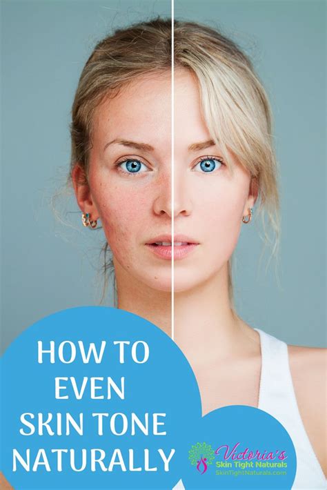 How To Even Skin Tone Naturally Skin Tight Naturals Aknenarben