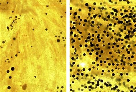 The Emergence Of Dermo Disease In Oysters Understanding The Role Of