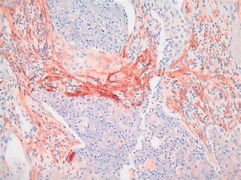 Full Article Fibroblast Activation Protein Fap Targeted Car T Cells
