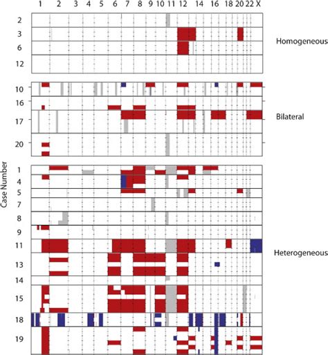 Scope Of Intra Tumor Copy Number Heterogeneity In 20 Wilms Tumor Cases Download Scientific