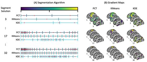 Segmentation Of The Principal Gradient Segmentation Of The Principal Download Scientific