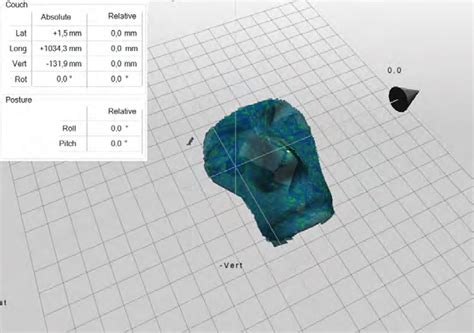 The Live Surface And The Reference Surface In Perfect Alignment Download Scientific Diagram