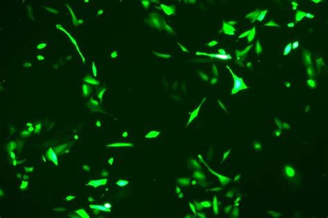 Oricell®mcf 7 With Gfp