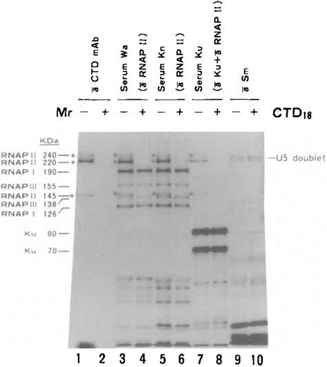 Figure 2 From Autoimmunity To Rna Polymerase Ii Is Focused At The