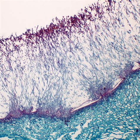 Fungi Microscope Slides At Nick Lopez Blog