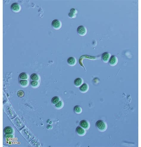Chroococcus Obliteratus Galerie
