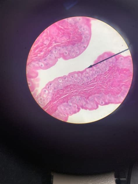 Stratified Squamous Artofit