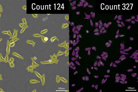 Precision And Efficiency With AI Enhanced Cell Counting Learn Share Leica Microsystems