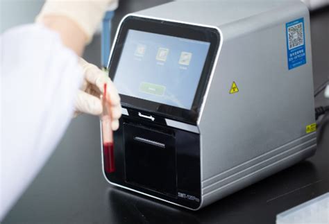 生化分析仪检查项目有哪些？ 斯马特