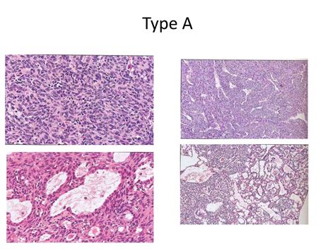 Pathology Of Thymus Pptx