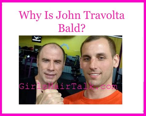 Why Is John Travolta Bald Find Out The Truth