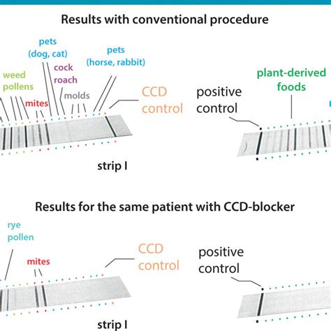 Example Of The Effect Of Ccd Inhibition Serum Of A 46 Year Old Male