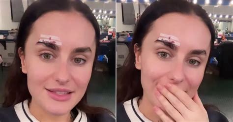 Amber Davies Suffers Nasty Injury In The Middle Of Pretty Woman Performance And Forced To Pull