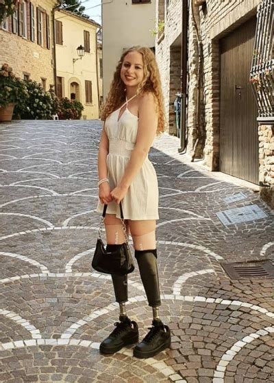 Lovely Dbk And Finger Amputee Girl From Germany Tumbex