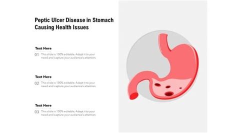 Peptic Ulcer Powerpoint Templates Slides And Graphics