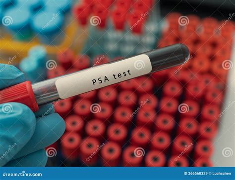 Psa Test Result With Blood Sample Tube Stock Image Image Of Gland