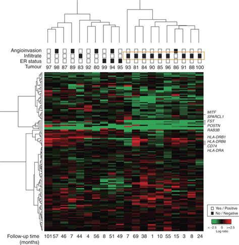 Unsupervised Hierarchical Clustering Obtained With 94 Genes