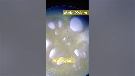 Metaxylem Protoxylem Pholem Ts Of Stem Cucurbita Shortvideo Videoshort Youtube