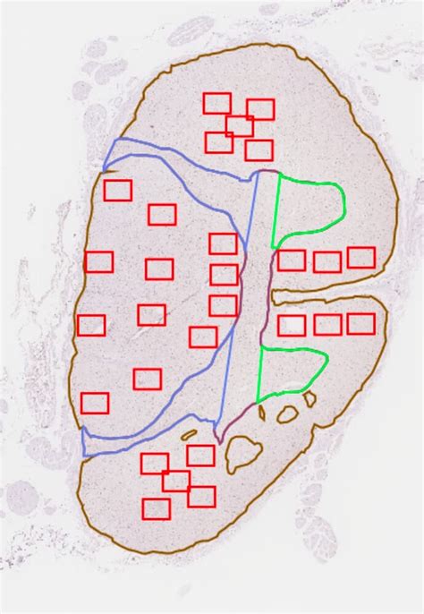 batch resize annotations qupath image analysis image sc forum