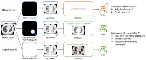 Explainable Ai To Support Medical Diagnosis Silvias 🌸 Medium