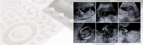 Abnormal Anatomy Scan