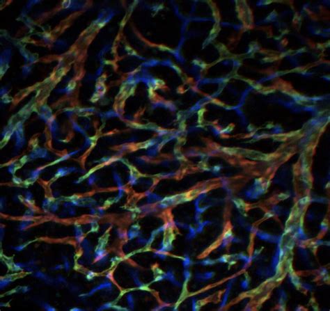 Intravital Imaging Tikhonova Lab