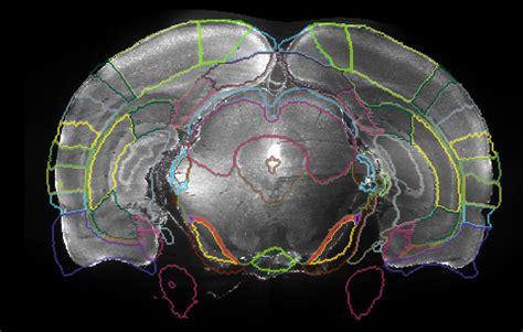 optimizing a brainreg fit image analysis image sc forum